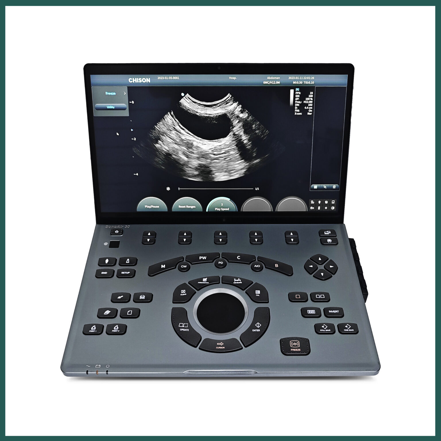 Ecógrafo Chison SonoAir 30 VET - KIT-VET