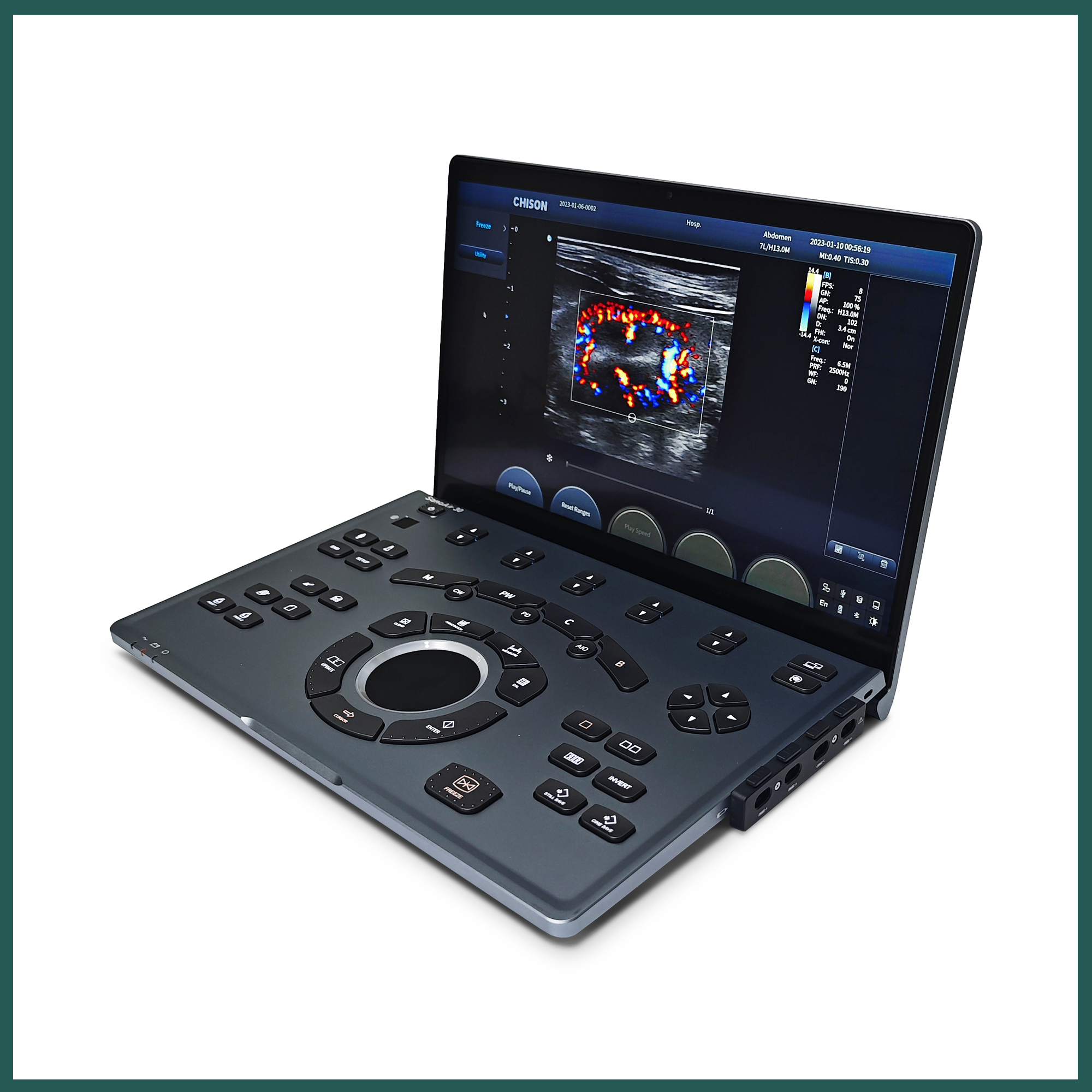 Ecógrafo Chison SonoAir 30 VET - KIT-VET